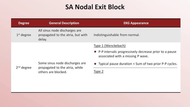 20 Advanced EKGs - Sinus Node Dysfunction