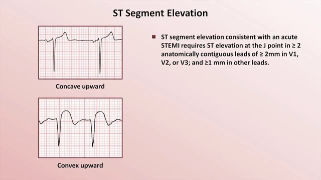 13 Intro to EKG Interpretation - QRST Changes  Eric Strong
