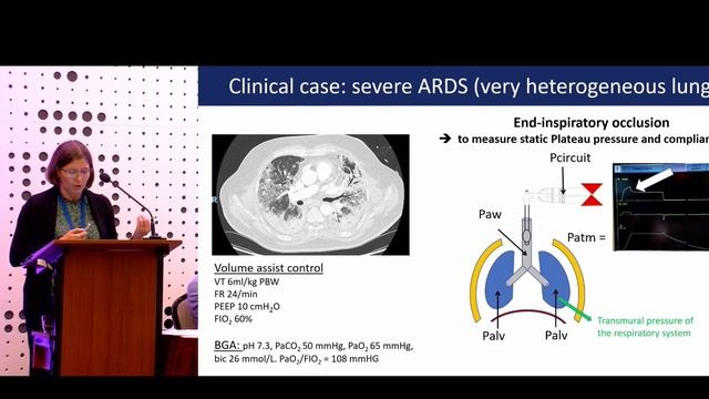 LIVES PHYSIOLOGY 05.06.25 Pendelluft - Piquilloud L.