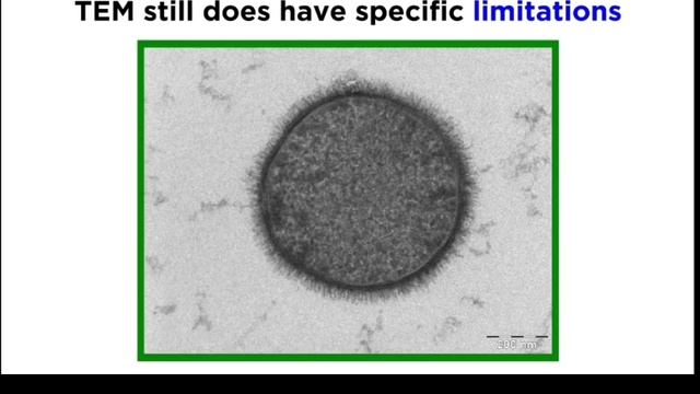 электронная микроскопия обьяснение