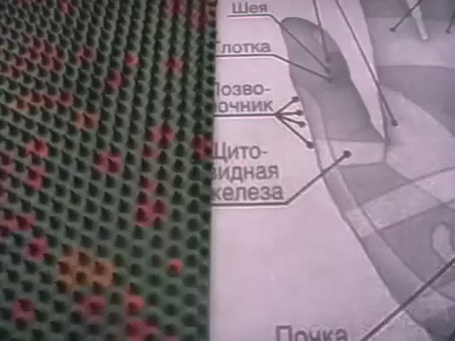 Как решать проблемы с поясницей?