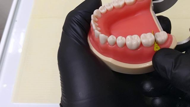 Клин с защитой от повреждения.