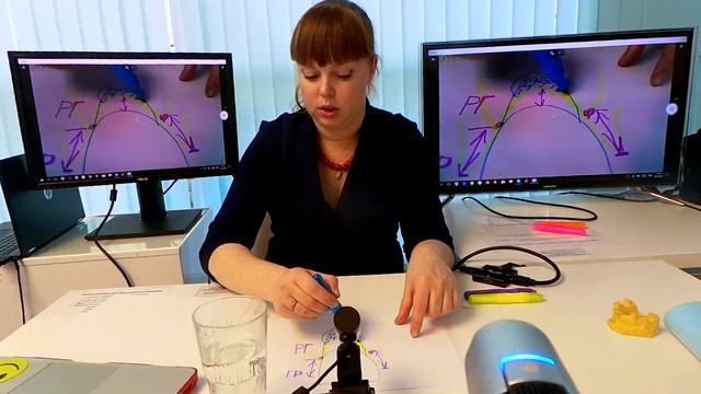 Лечение рецессий десны 10.11.17. Носова Мария. Эпизод 6