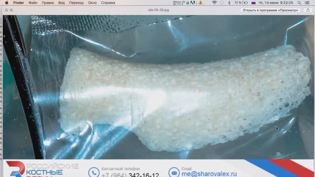 Индивидуальные костные бло-ки Russian Bone Blocks для ре-конструкции челюстей. Часть 2