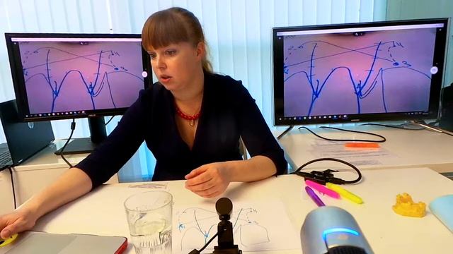 Лечение рецессий десны 10.11.17. Носова Мария. Эпизод 9