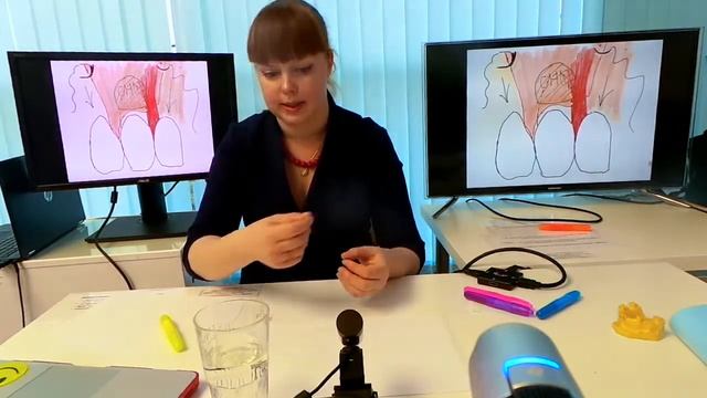 Лечение рецессий десны 10.11.17. Носова Мария. Эпизод 8