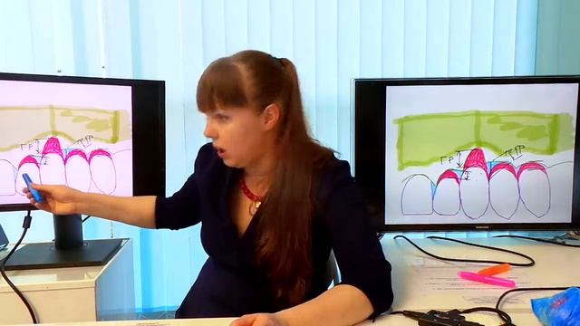 Лечение рецессий десны 10.11.17. Носова Мария. Эпизод 17