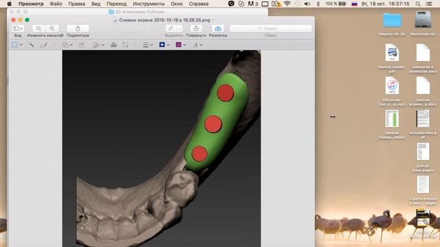 Создание высокоточной трех-мерной модели индивидуаль-ного блока. Часть 2