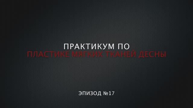Практикум по пластике мягких тканей десны в области зубов и имплантатов. Часть 17