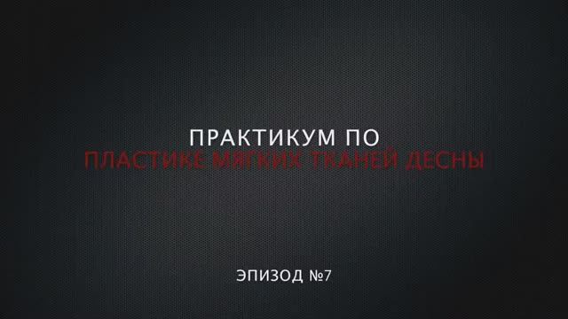 Практикум по пластике мягких тканей десны в области зубов и имплантатов. Часть 19
