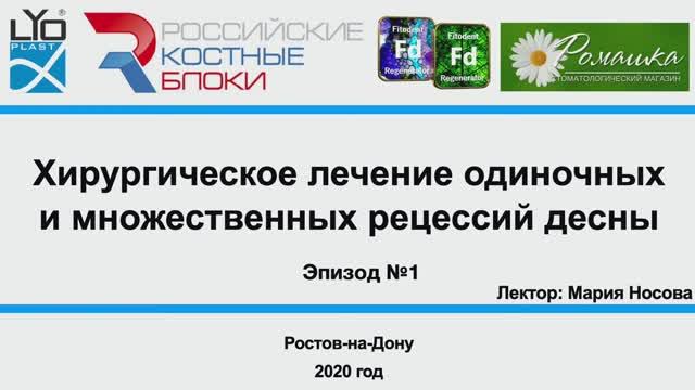 Лечение рецессии десны Часть 1. Ростов-на-Дону 2020