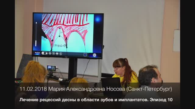 Лечение рецессии десны 11.02.18. Носова Мария. Эпизод 10