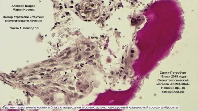 Выбор стратегии и тактики лечения 1.10
