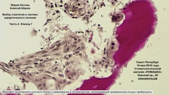 Выбор стратегии и тактики лечения 2.7