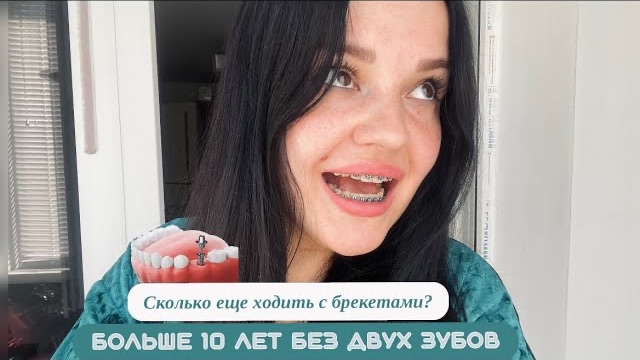 Что мне сказал стоматолог ? имплантация зубов, наращивание костной ткани и боль