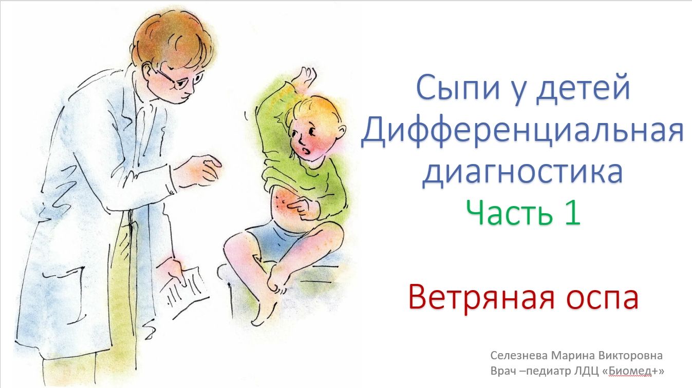 Ветряная оспа