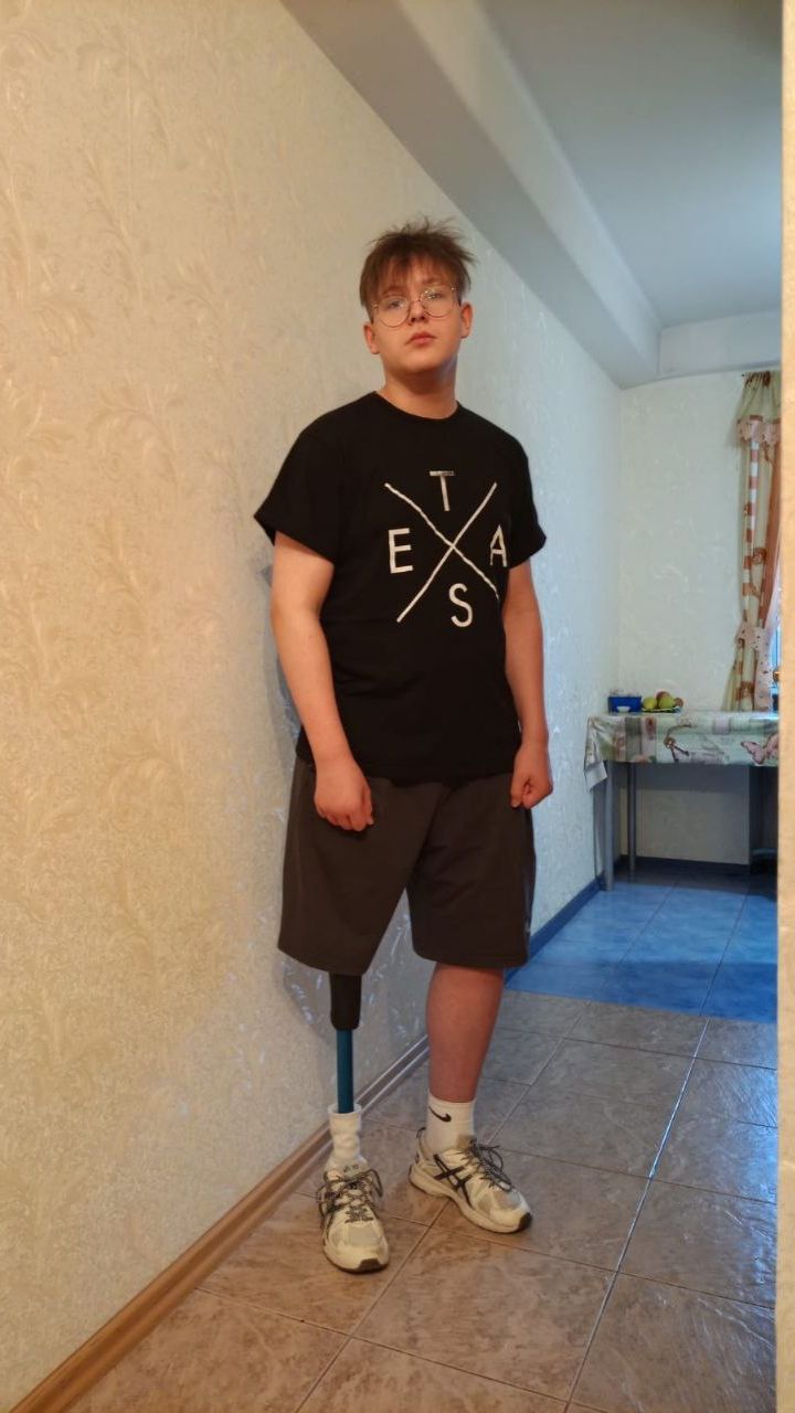 Кирилл ходит на кибер ноге