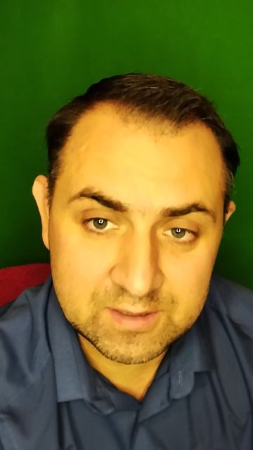 Мерфизмы в стоматологии 11. Не готовь эндодонтию раньше прихода пациента.