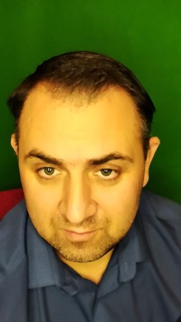 Мерфизмы в стоматологии 10. При отъезде в отпуск не меняйте пломбы пациентам.