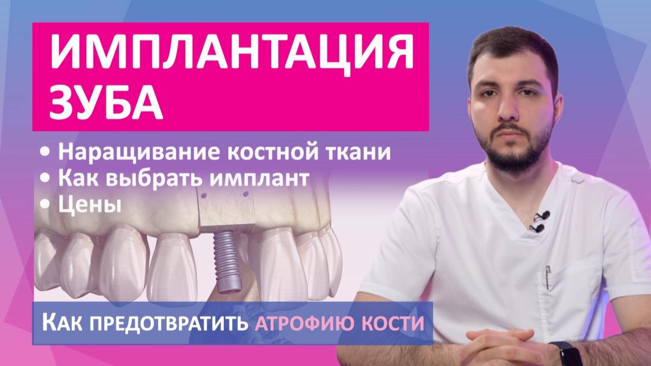 Все об имплантации зуба: как выбрать зубной имплант, наращивание костной ткани, цены на импланты.