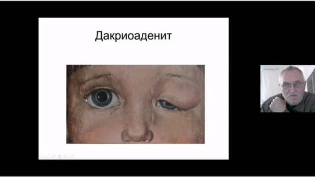 4 ПАТОЛОГИЯ СЛЕЗНЫХ  органов и КОН-ВЫ     11  09  2021