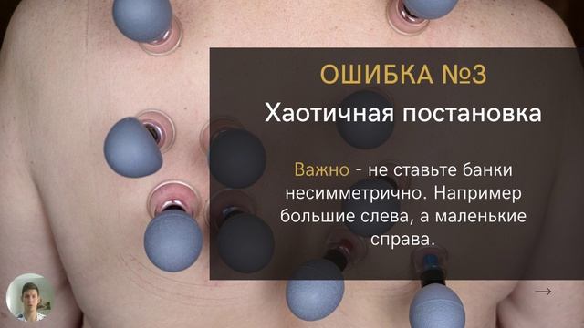 Баночный массаж 01-12 ошибок начинающих ч.1