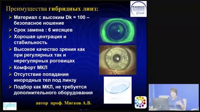 Лекция ОПТИЧЕСКАЯ Коррекция аметропий .mp4