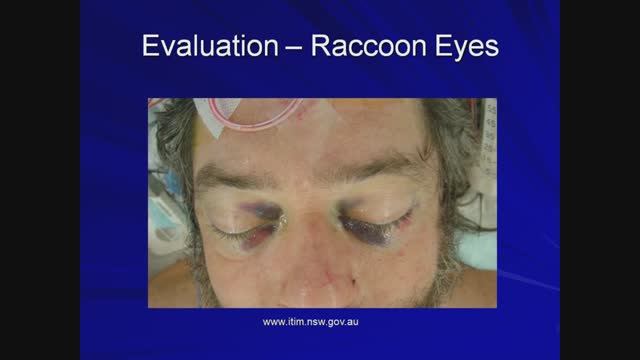 Coma - Part 2 of 3 Eric Strong