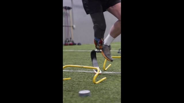 Тренировка после установка протеза на одну ногу