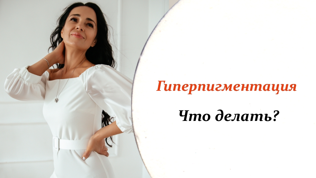 Гиперпигментация и методы лечения