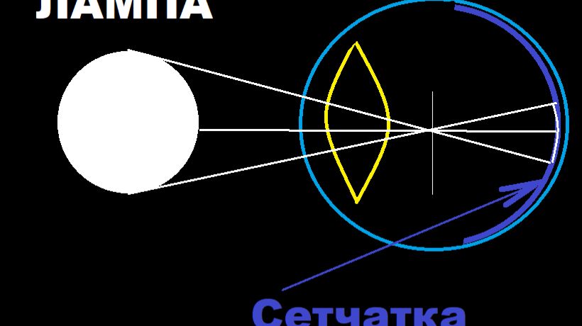 Шарообразный ГЛАЗ. Центральная фиксация оптических осей. Активизация нервных клеток СЕТЧАТКИ!