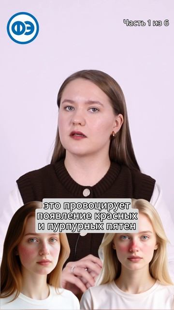 1 часть: Как ухаживать за кожей с куперозом? 🍁