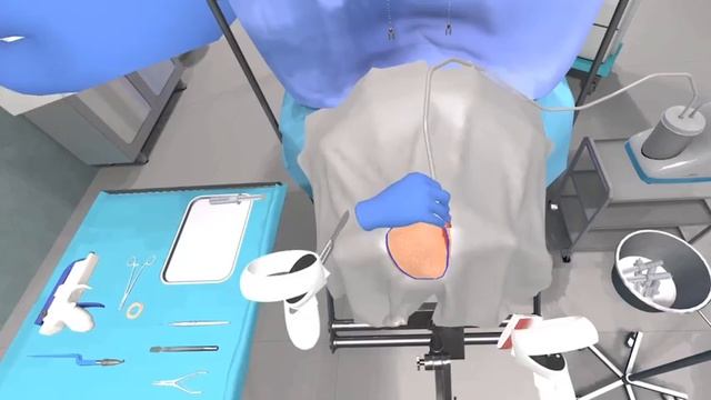 Хирургическая операция — декомпрессионная краниотомия