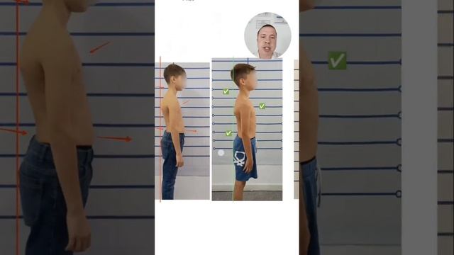 Головные боли у детей. Неочивидная причина и пути решения.