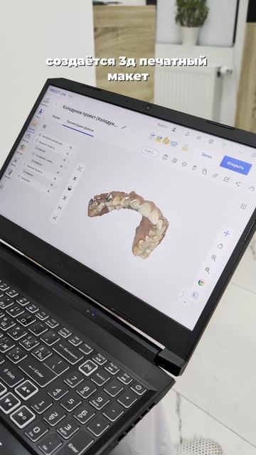 3D сканирование в стоматологии / Используют при установке коронок и имплантов, лечении на элайнерах