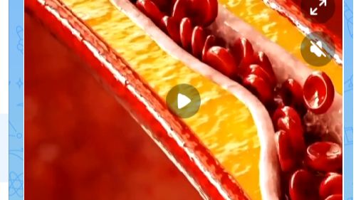 Жизнь и ПРОЗРЕНИЕ. Мигание через 1 удар сердца. Господи помилуй. 2 цветных звезды Симменса!