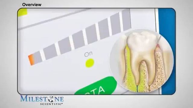 Обзор инъекционной системы CompuDent STA