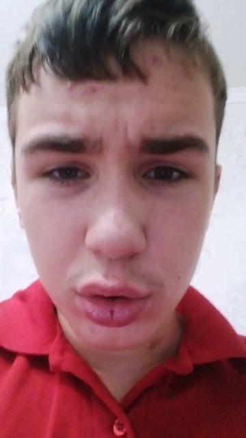 наш клоун умер 😭😥часть 10