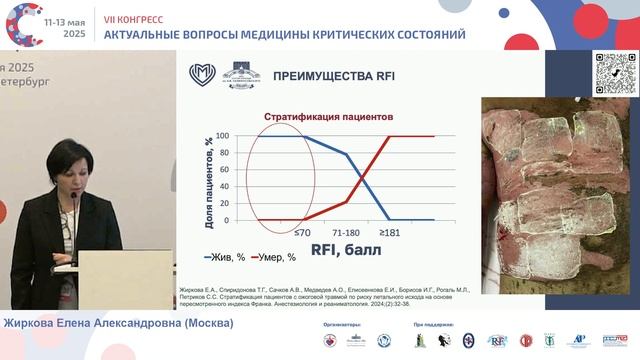 Прогностическая оценка тяжести термической травмы Жиркова Е.А.