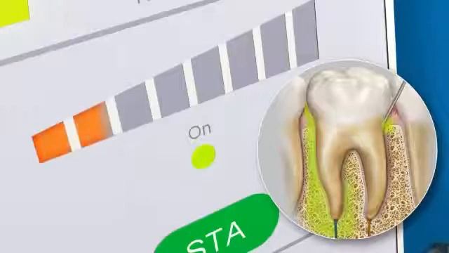 Функциональные возможности STA Compudent