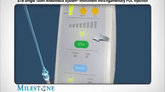 CompuDent STA - компьютерная анестезия