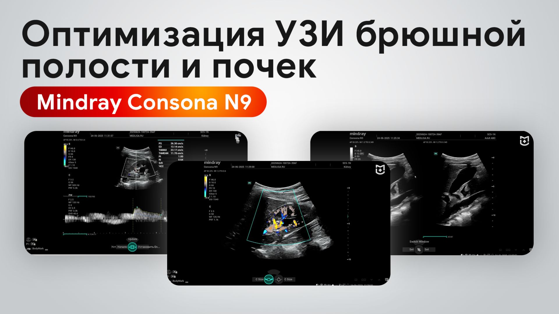 Оптимизация изображения при исследовании брюшной полости и почек на Mindray Consona N9