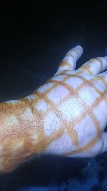 Травмы лечим подорожником