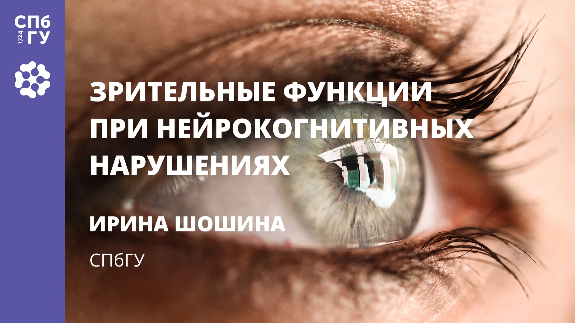 Ирина Шошина «Зрительные функции при нейрокогнитивных нарушениях»