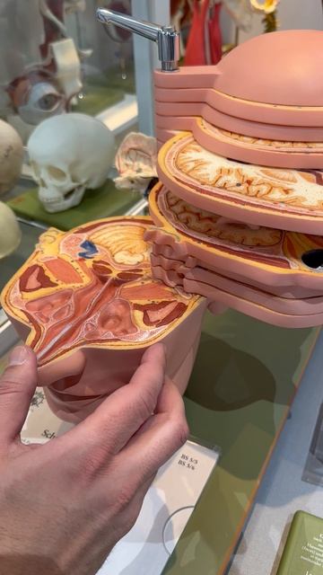 Макет головы из срезов МРТ