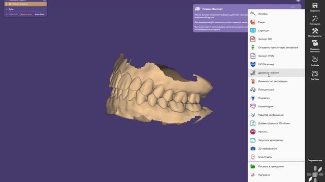 Импортирование файла движения нижней челюсти в ExoCad