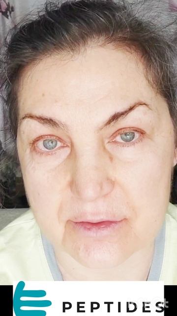 После 35 Q10 принимать постоянно!