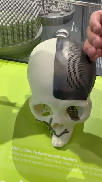 Титановые костные импланты 3D-печать