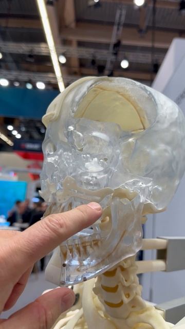 Технологии 3D-печати медицинских имплантов