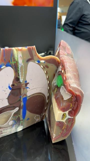 Напечатанные на 3D-принтере макеты органов для обучения